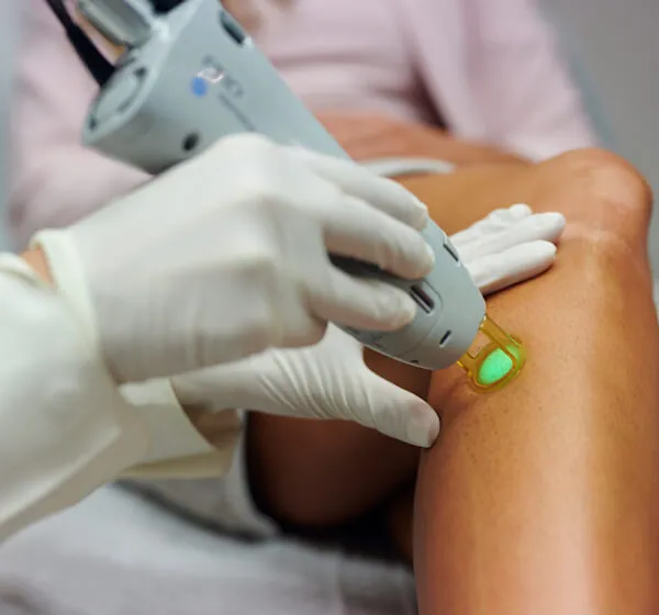 Laser Hair Removal in Melbourne Safe Lasting Hair Removal